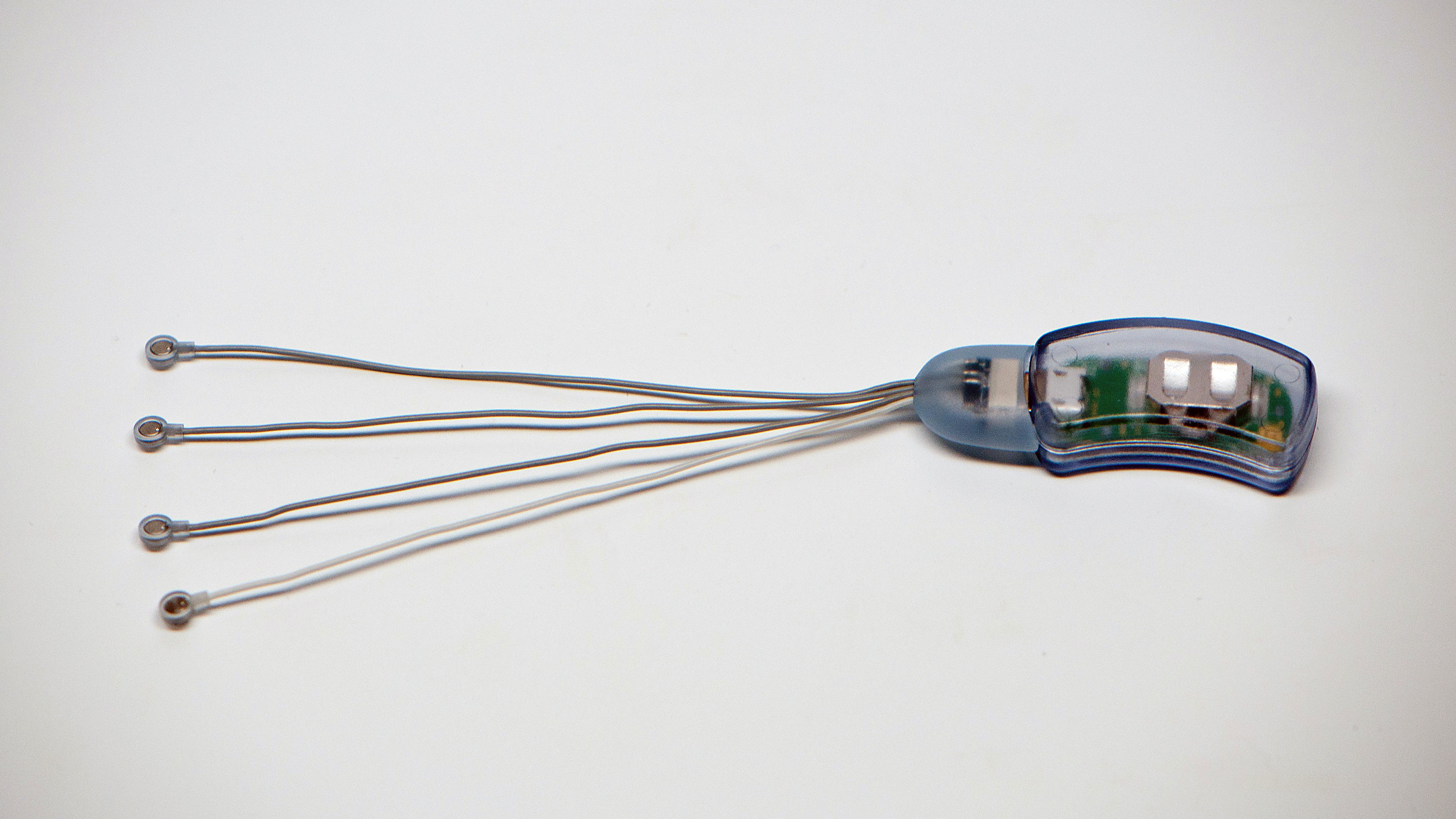 FDA clears nerve stimulator to aid recovery from opioids – Boston 25 News