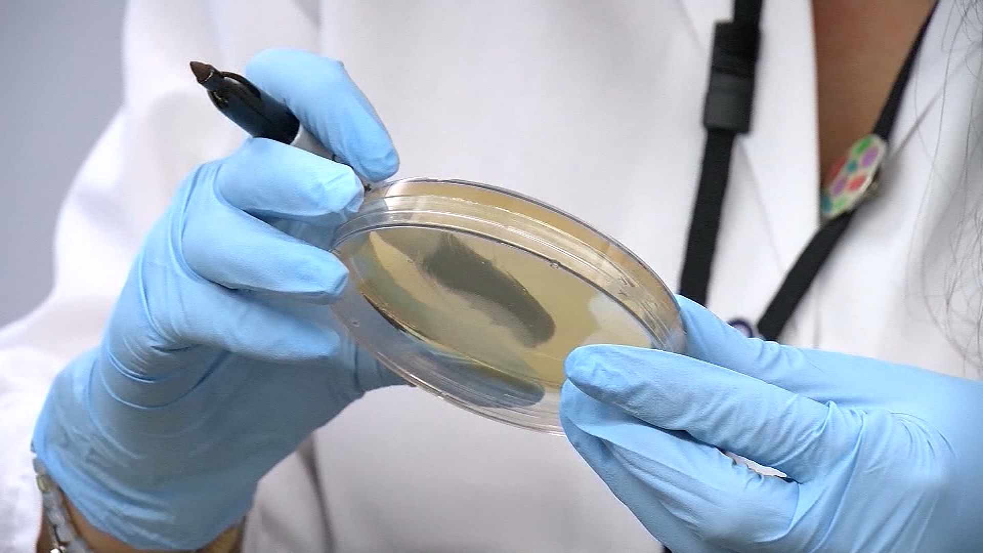 Mass. DPH: Second presumptive positive case of COVID-19 identified in ...